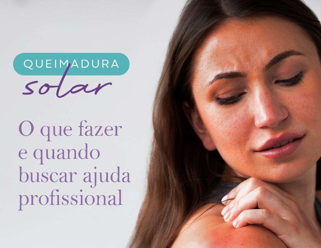 Queimadura Solar - Viesi